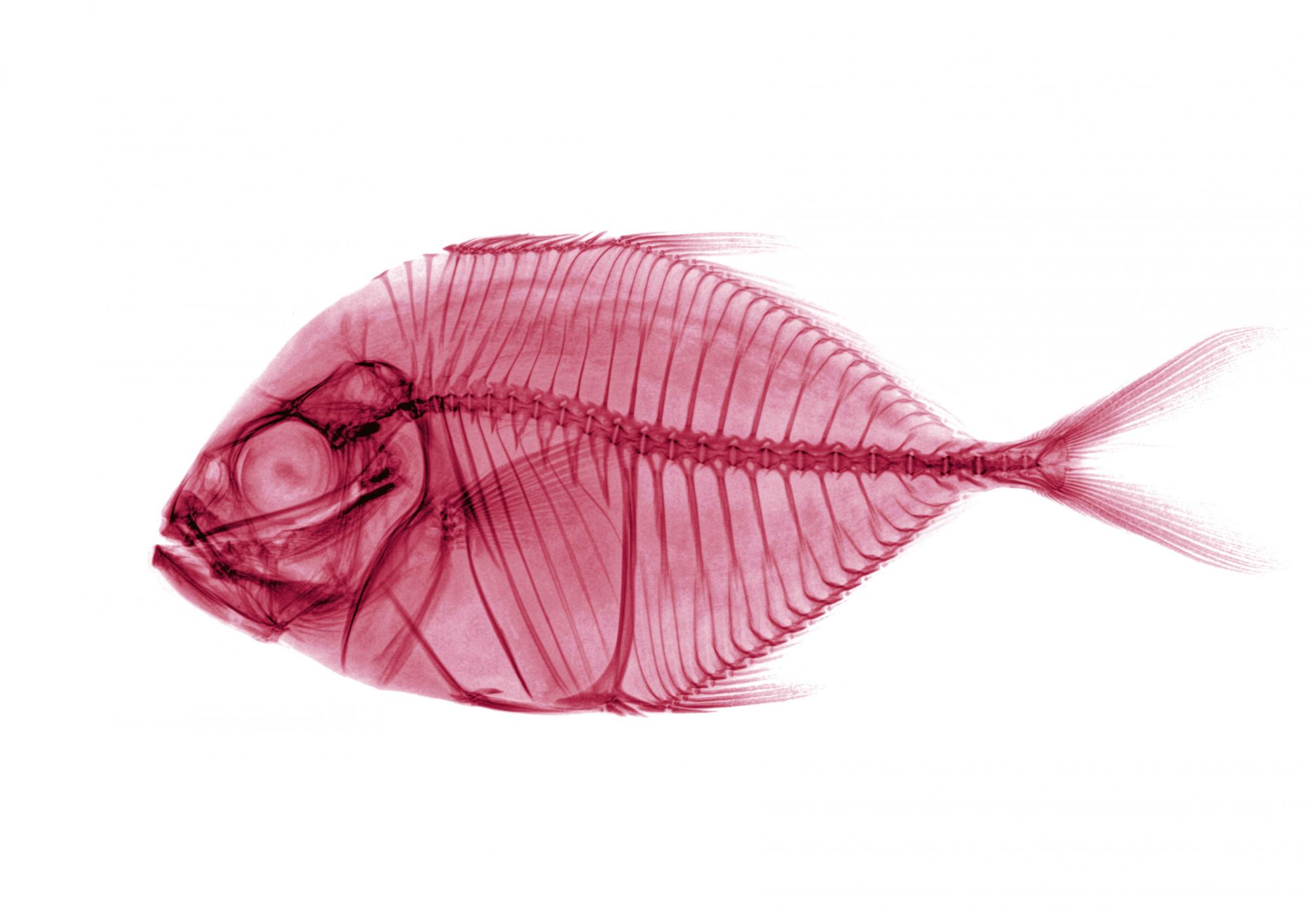 X-Ray Prints | Western Australian Museum